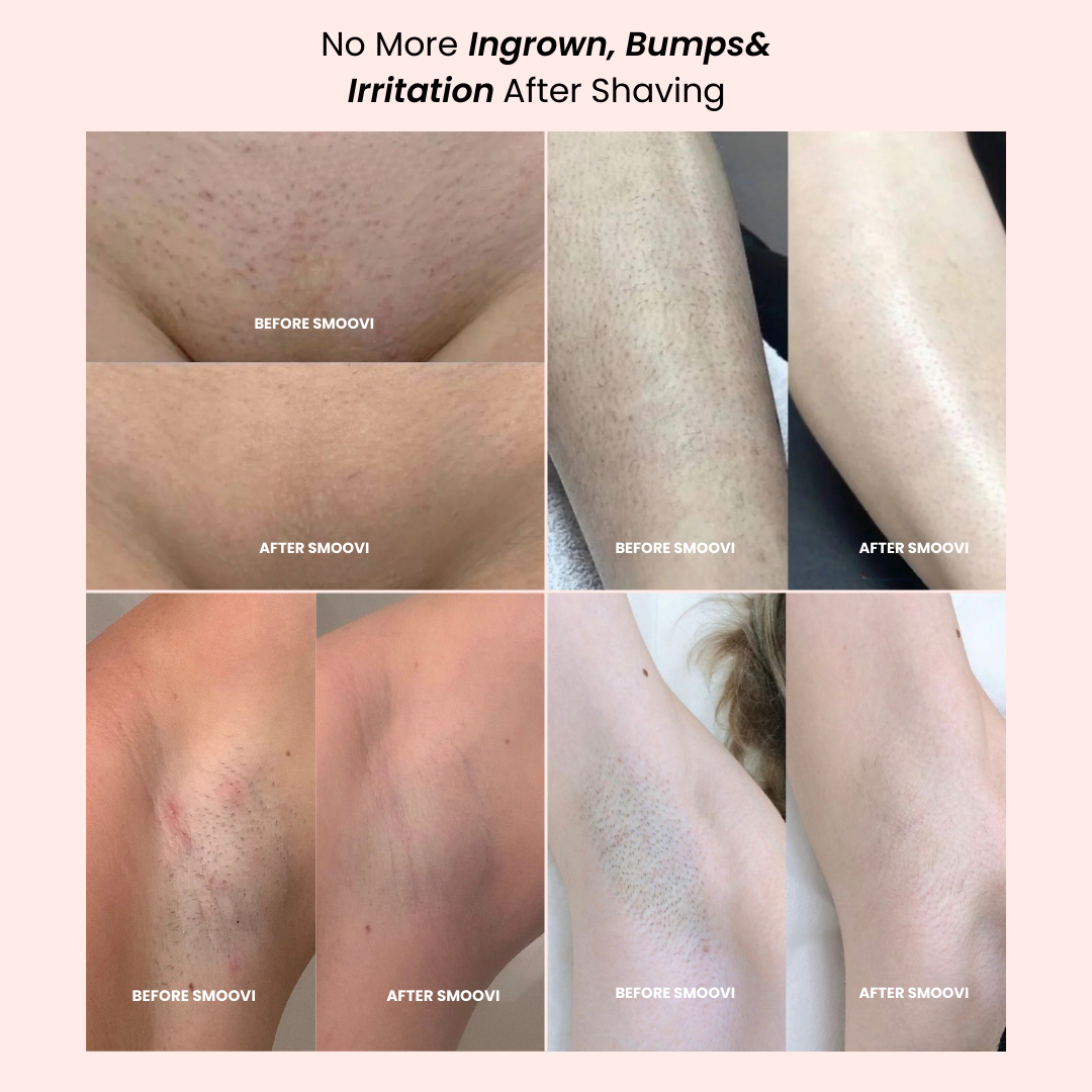 SMOOVI 2.0 Bikini Shaver by PetalSmooth