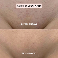 SMOOVI 2.0 Bikini Shaver by PetalSmooth