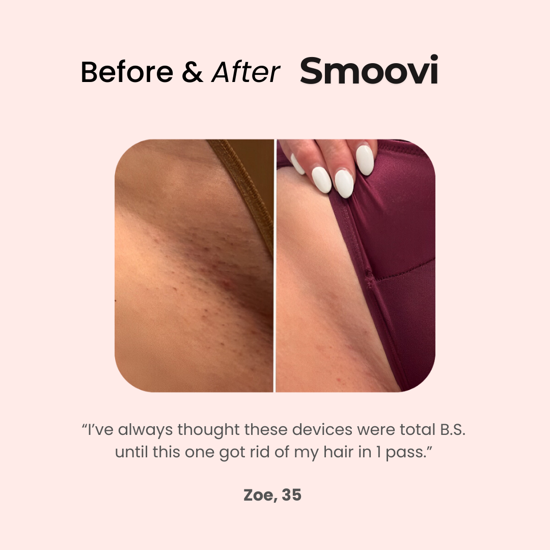 SMOOVI 2.0 Bikini Shaver by PetalSmooth